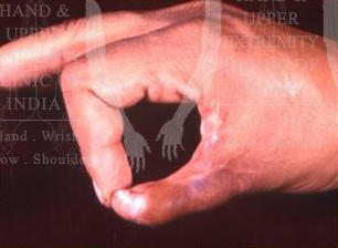 Case Studies | Hand Surgery Clinic
