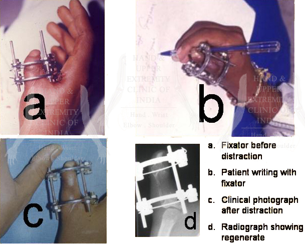 Case Studies | Hand Surgery Clinic